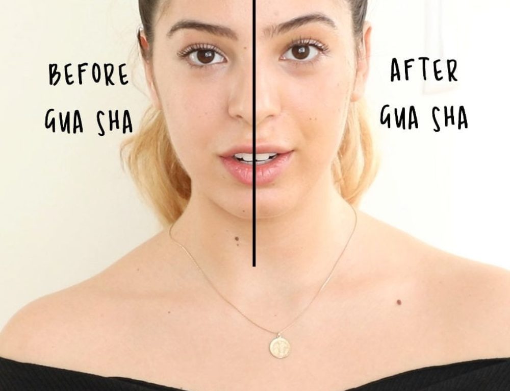 Hair Loss Solution - MicroArt™ Scalp Shading, Amazing Results ...