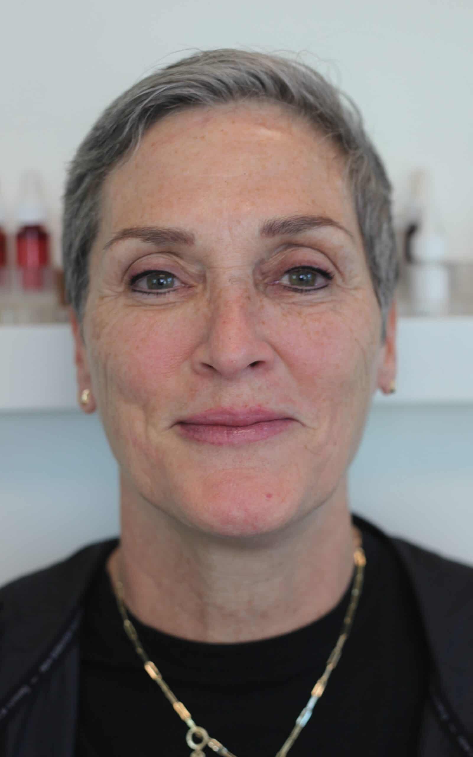 Right After Procedure Photos - MicroArt Semi Permanent Makeup