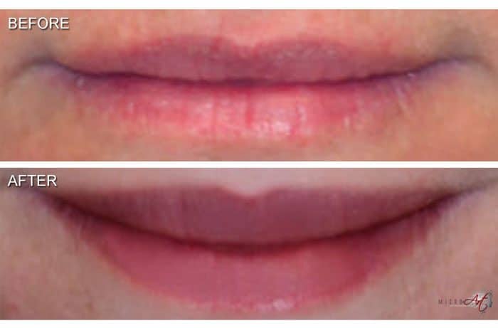 Permanent Lip Makeup | Natural Lip Blush Enhancement | MicroArt