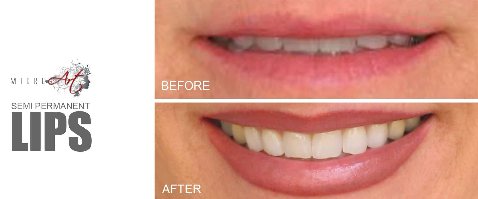 Permanent Lip Makeup | Natural Lip Blush Enhancement | MicroArt